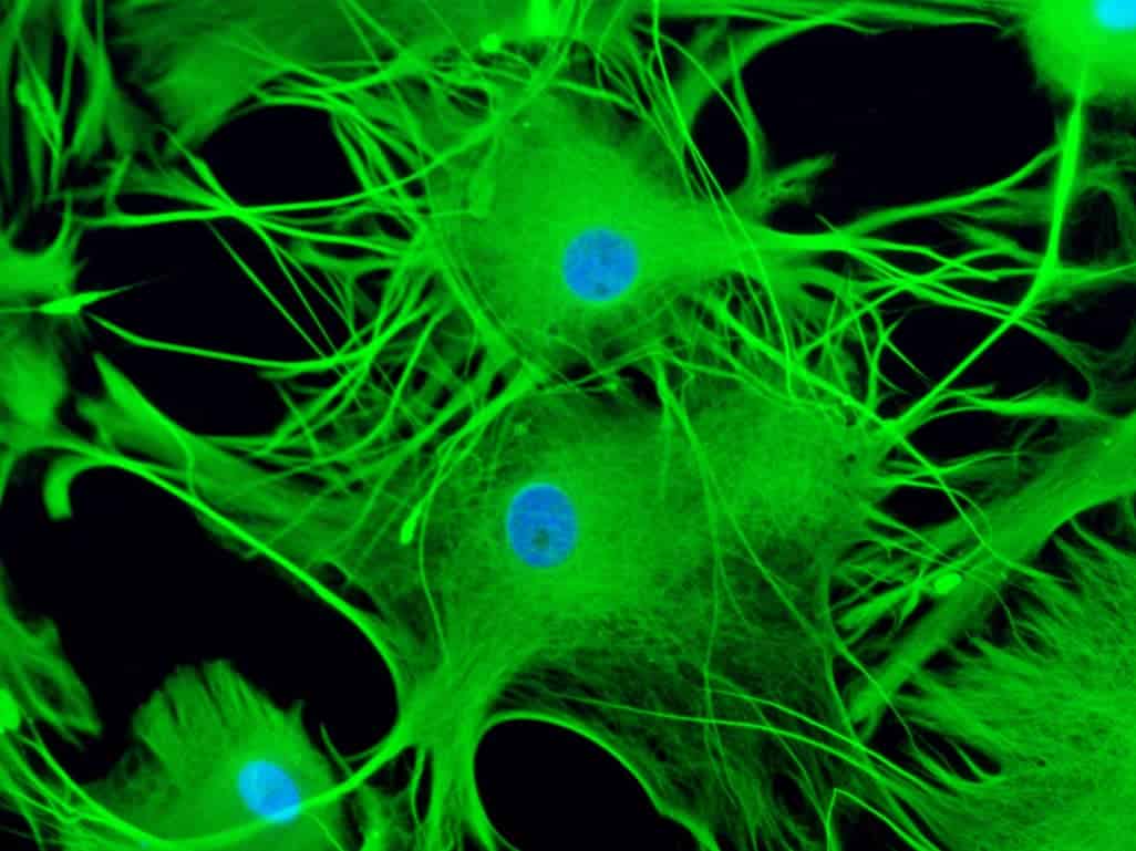 stem cell transplant | Stories of Australian Science, from Science in ...